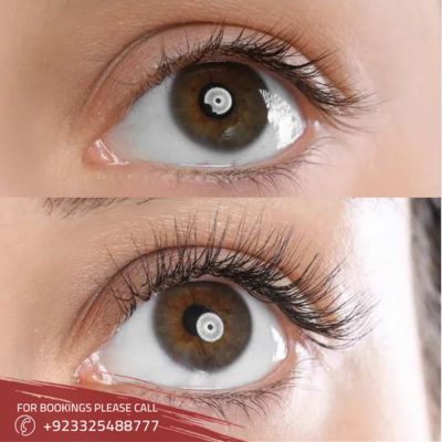Eyelash extension in Islamabad - SKN Cosmetic & Plastic Surgery Clinic ...
